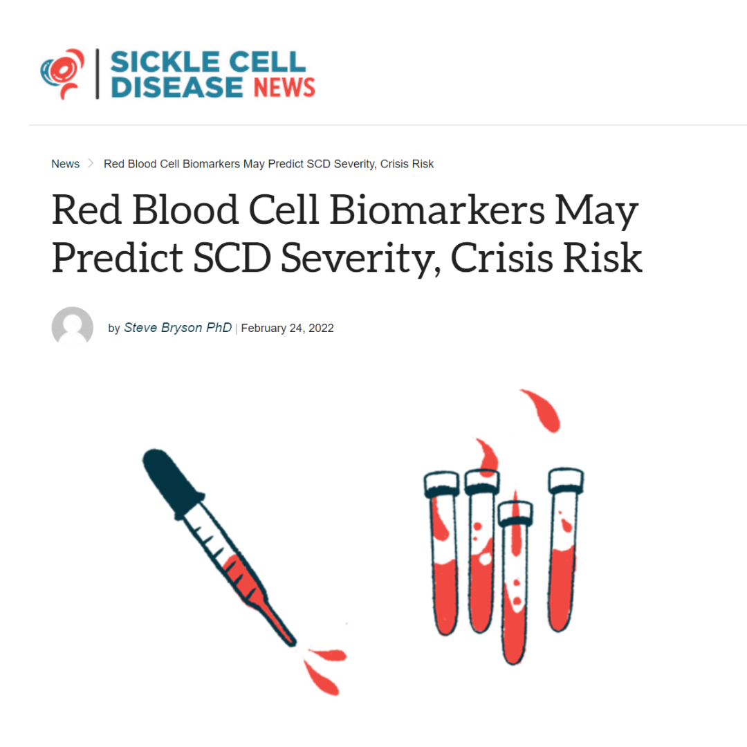 Red blood cell biomarkers may predict sickle cell disease (SCD ...